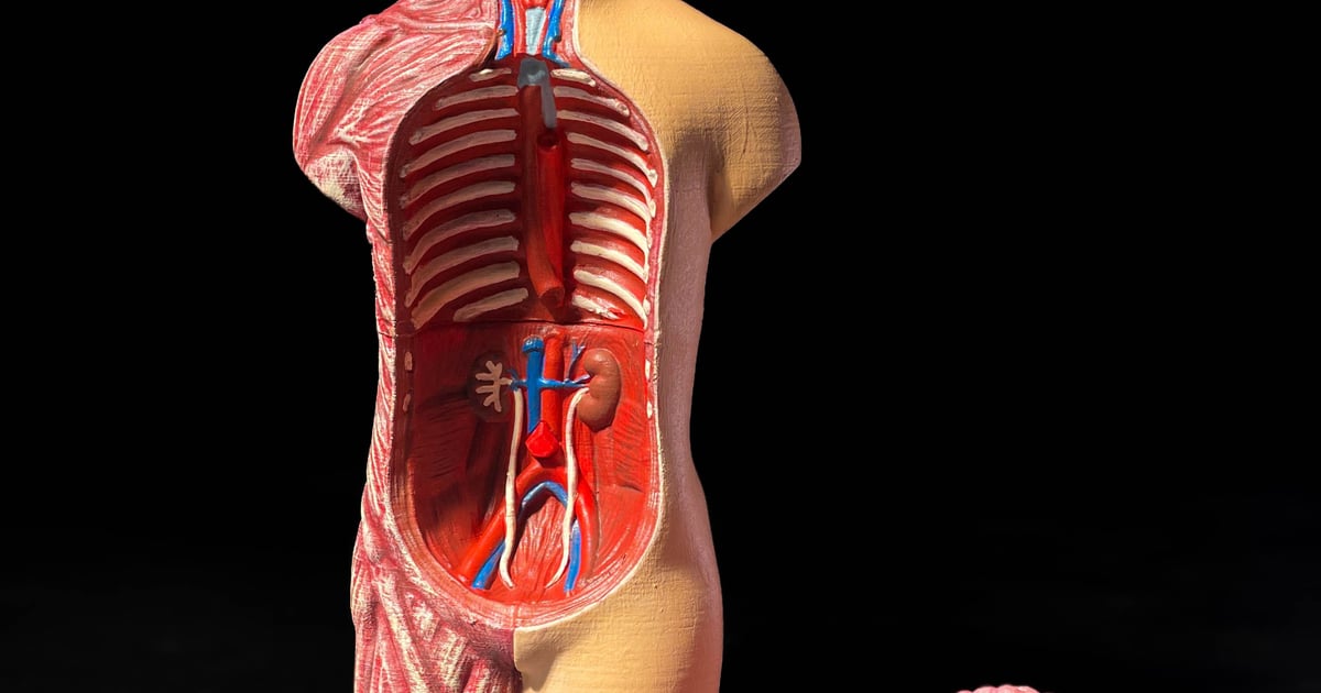3D printed anatomical model | FNQ 3D Printing