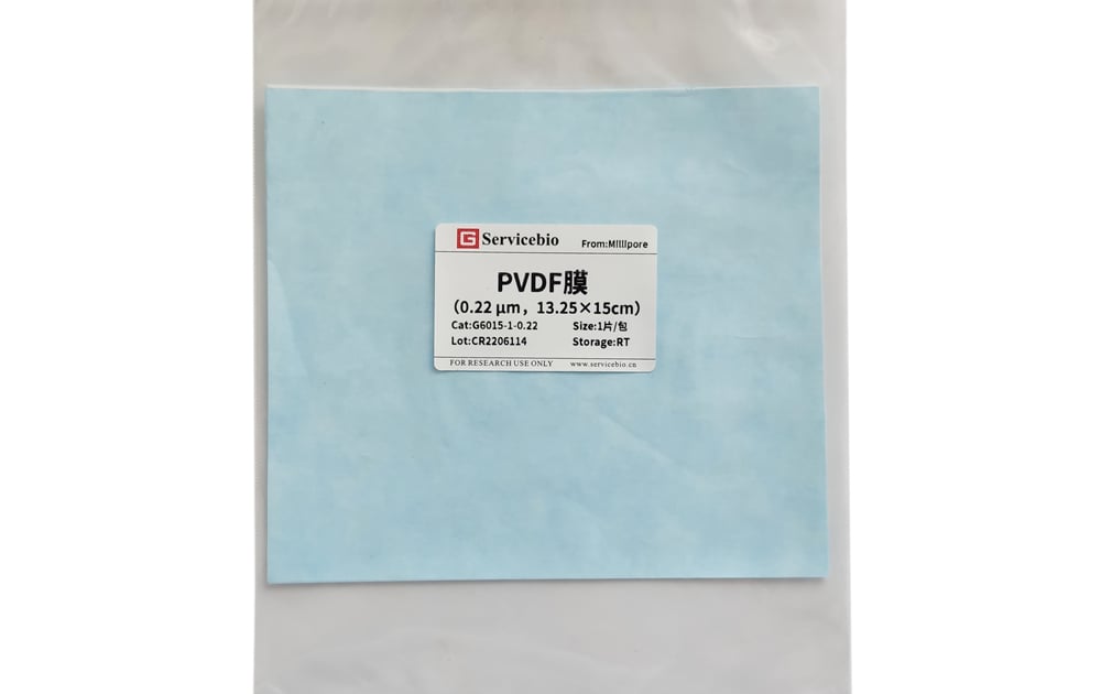 PVDF Membrane | Envision Sciplus
