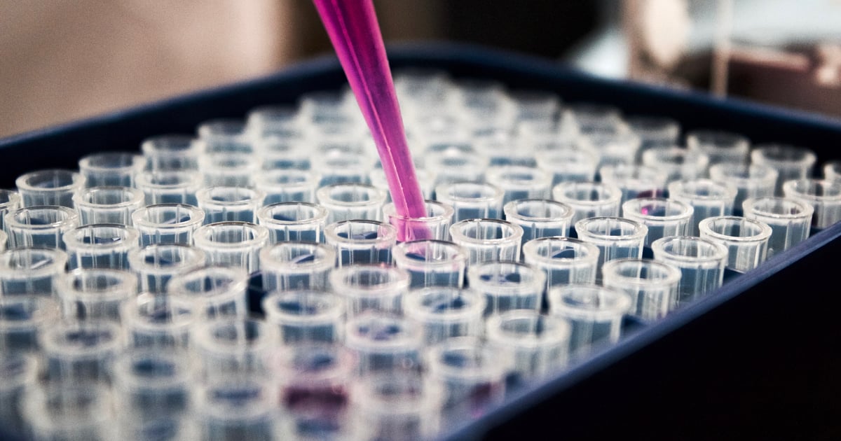 Serología | LIPEPSA