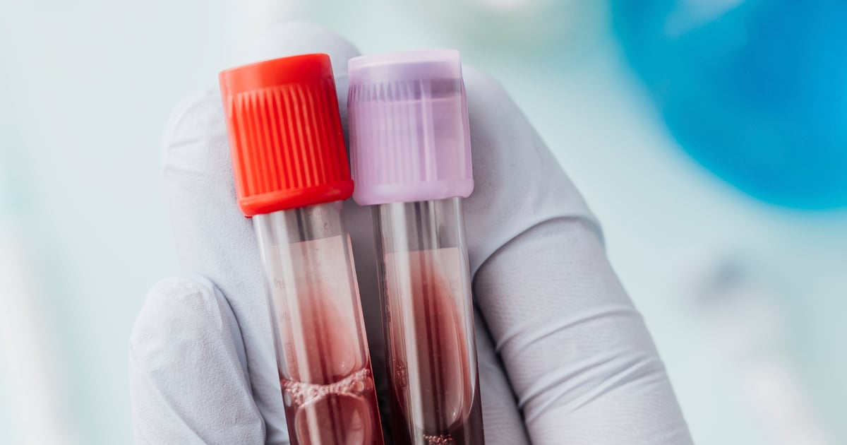 Bioquimica clínica | LIPEPSA