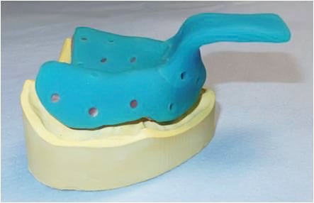 SPECIAL TRAY | ARABIAN DENTAL LAB