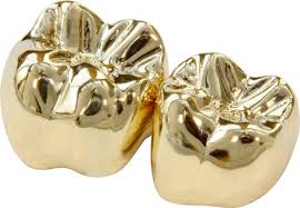 Gold Tooth Caps | Make my Tooth