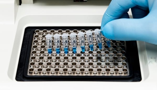 Biología molecular | LIPEPSA