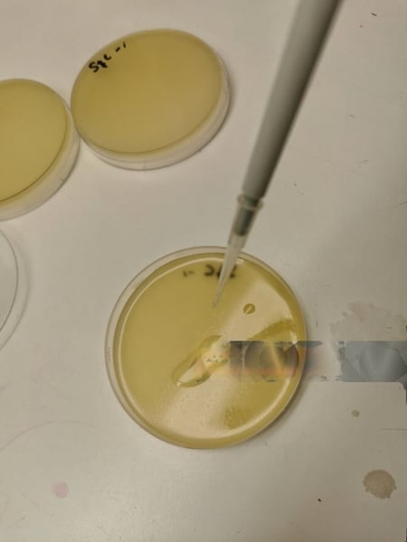 Bacteriología | LIPEPSA