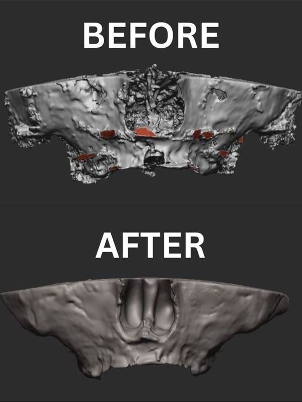 3D Model Reconstruction (From Dental CBCT) | Clear Simulations